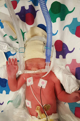 The devices you gave helped care for premature infants and sick newborns